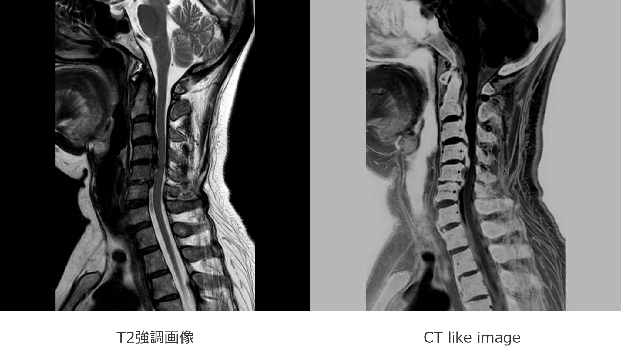 磁気共鳴医学会 〜CT like imaging〜 | Radiation Journal｜医学部生や医療従事者のための画像診断、医療情報サイト